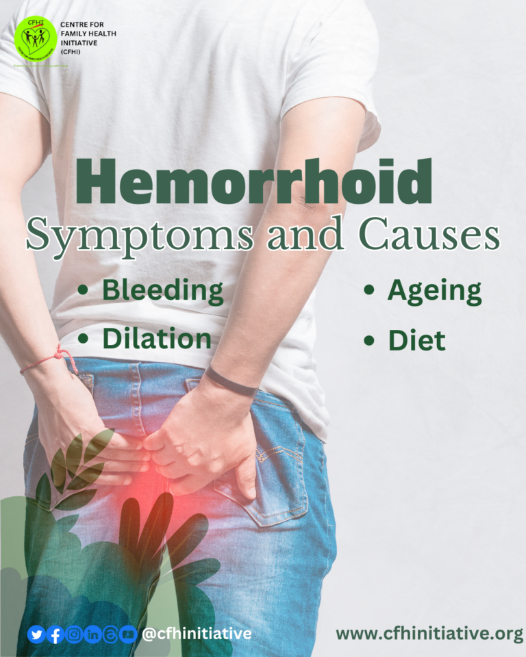 MONDAY HEALTH BURST ON HEMORRHOIDS – SYMPTOMS AND CAUSES – Centre for ...